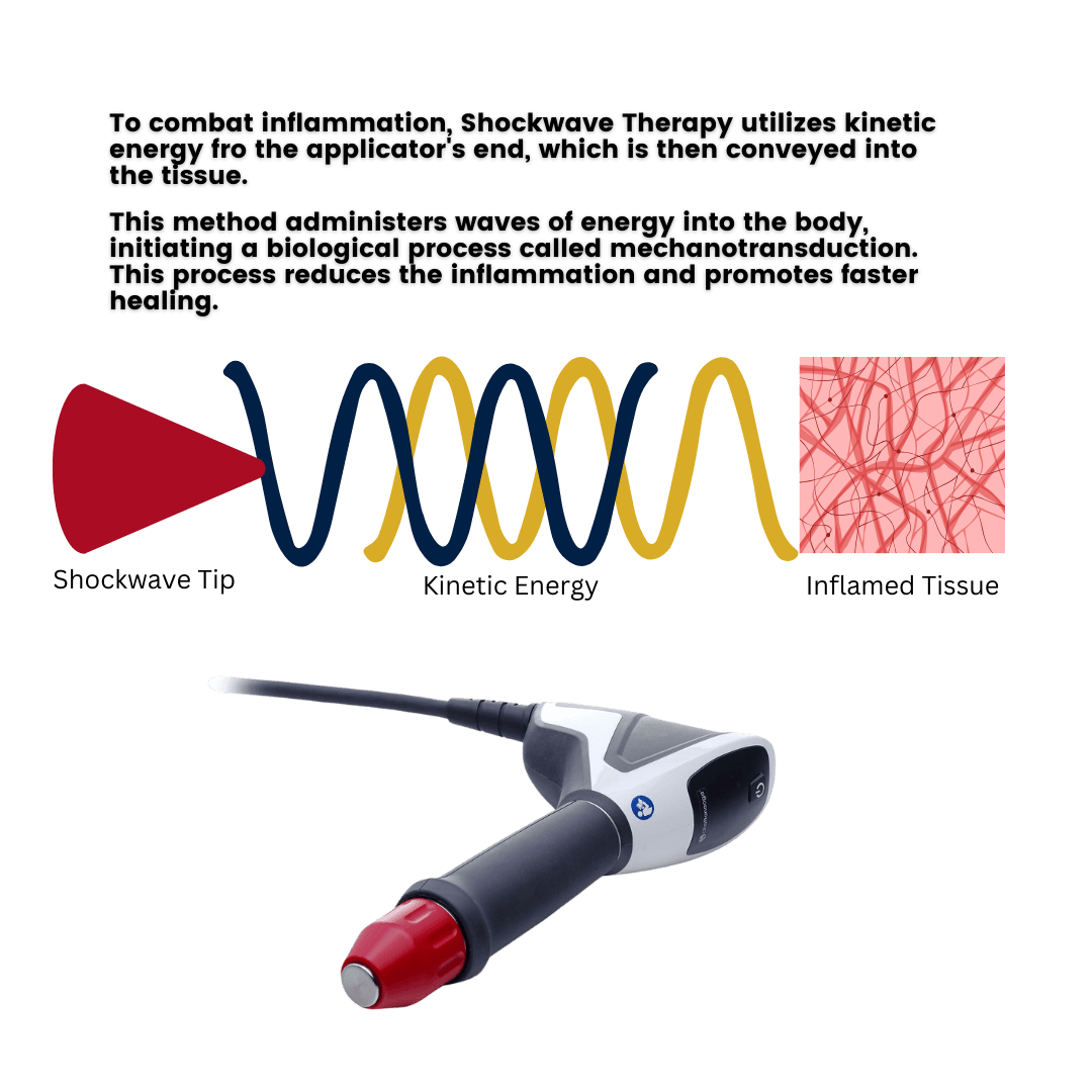 $49 Shockwave Therapy Package - Sync Chiropractic & Rehab